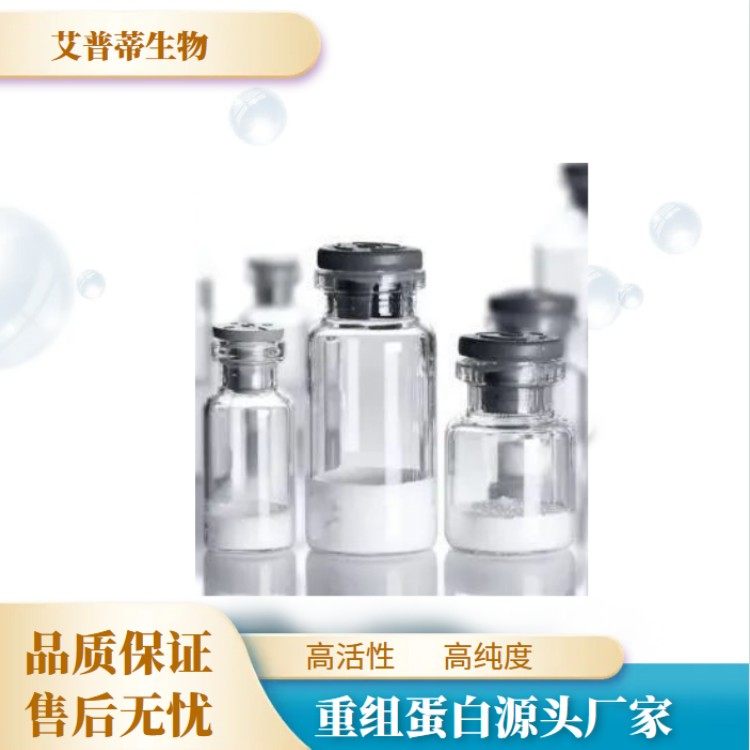 果糖二磷酸醛缩酶A(ALDOA)重组蛋白|Aldolase A,1-364aa, Human 产品关键词:果糖二磷酸醛缩酶aldoa