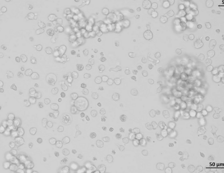 雅吉生物 4T1.2小鼠乳腺癌细胞骨转移模型 STR鉴定正确 上皮贴壁生长 - 百度爱采购