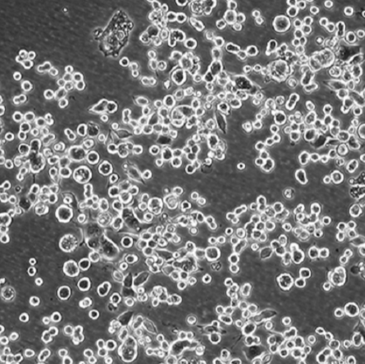 细胞（三阴性）HCC1187 上皮贴壁生长 代数低 活性高 科研实验必备