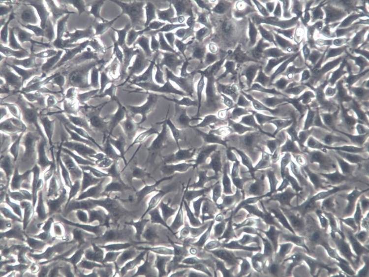 B16-OVA小鼠黑色素瘤细胞(OVA基因修饰)ATCC细胞库来源