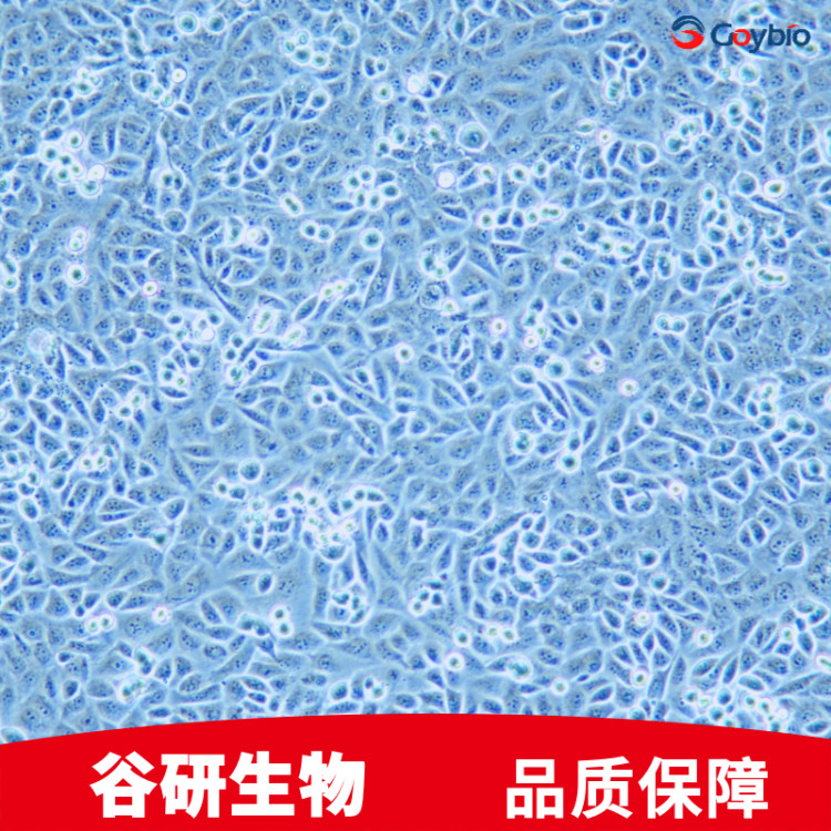 LX-2 (人肝星形细胞) (STR鉴定正确)科研细胞售后无忧