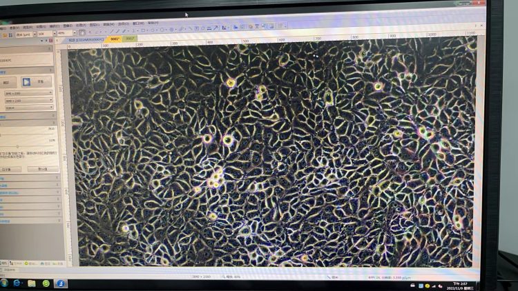 细胞a129l STR鉴定正确 灵敏度高 代数低 活性好 科研实验必备 - 百度爱采购