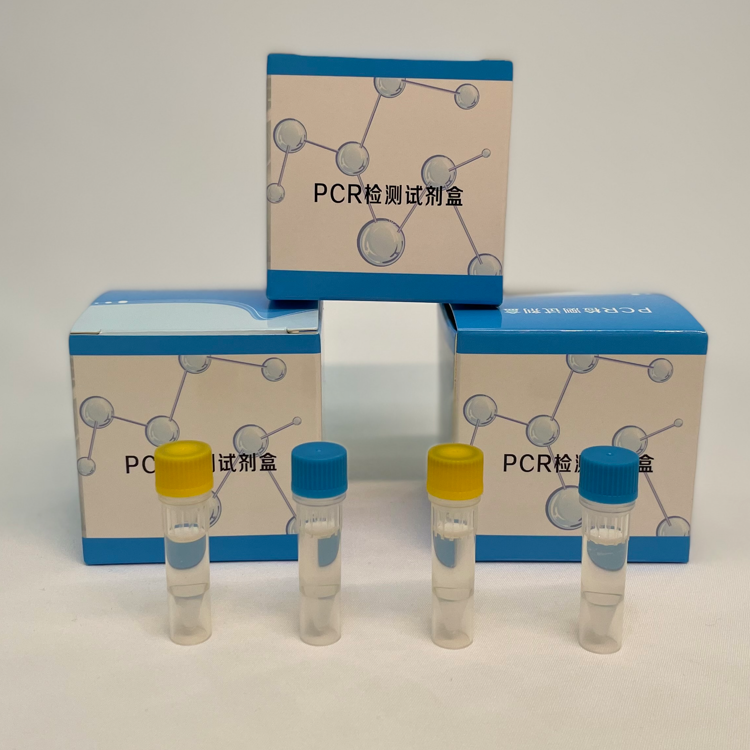 EB病毒(EBV)核酸检测试剂盒(荧光-PCR法) 灵敏度高