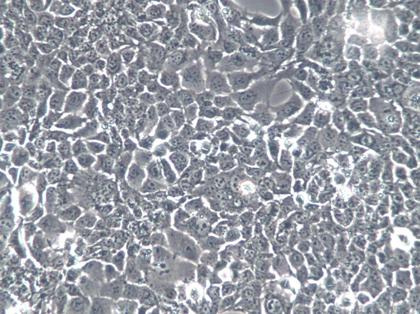HCC827细胞增殖凋亡实验人非小细胞肺癌细胞裸鼠皮下成瘤率 产品关键词:hcc827皮下