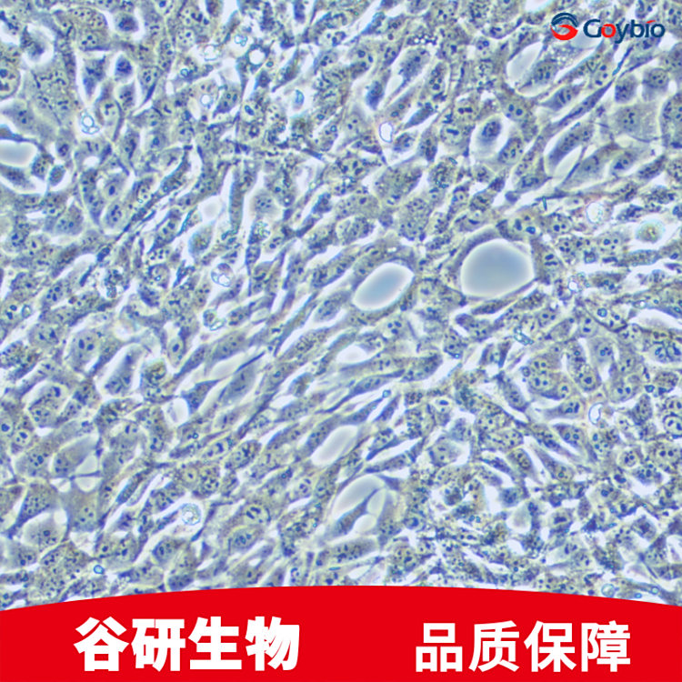 NCI-H1975 (人肺腺癌细胞) (STR鉴定正确)科研细胞